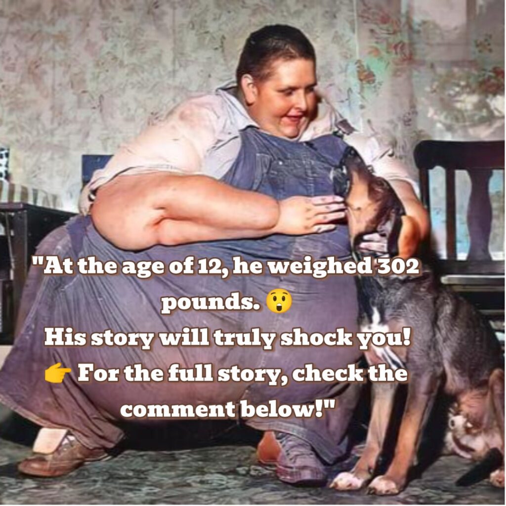 Jon Brower Minnoch: The Heaviest Person Ever Recorded, Weighing 1,400 ...
